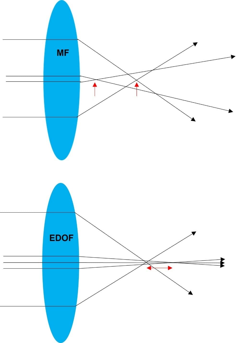 Tackling Ocular Menopause: Presbyopia Management Strategies - mivision