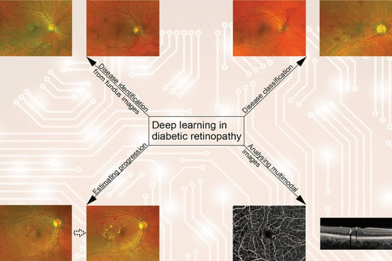 Deep Learning in the Retina - mivision