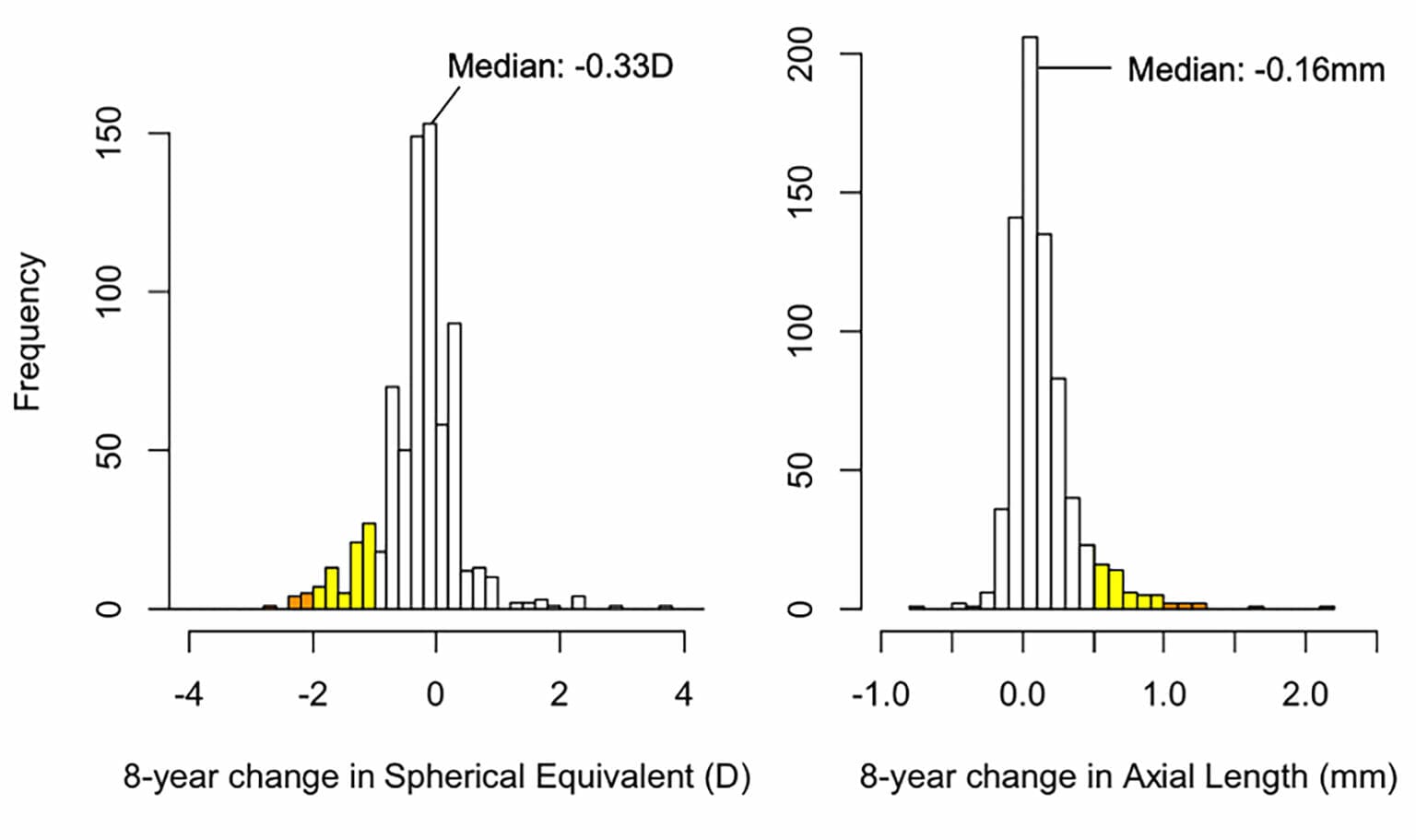 Myopia in Young Adults Is Onset and Progression Important? - mivision