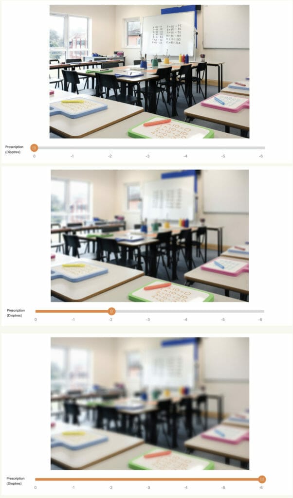 Managing Myopia Why it’s Important to Get Involved - mivision