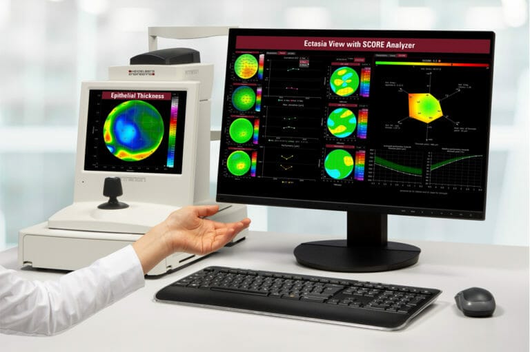 Ectasia View with SCORE Analyzer - mivision