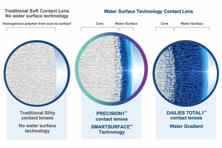 Water Surface Technology Contact Lenses vs. Traditional Soft Contact ...