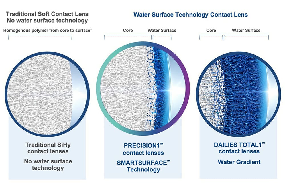 Water Surface Technology Contact Lenses vs. Traditional Soft Contact ...
