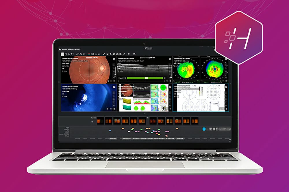 Topcon Harmony Data Management Solution - mivision Topcon Harmony Data Management Solution - mivision