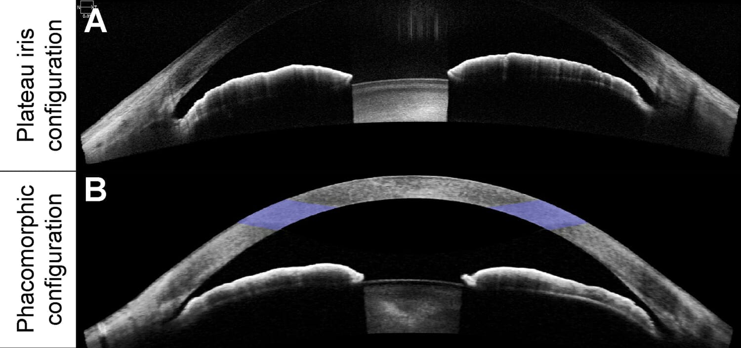 Unconventional Uses of Optical Coherence Tomography - mivision