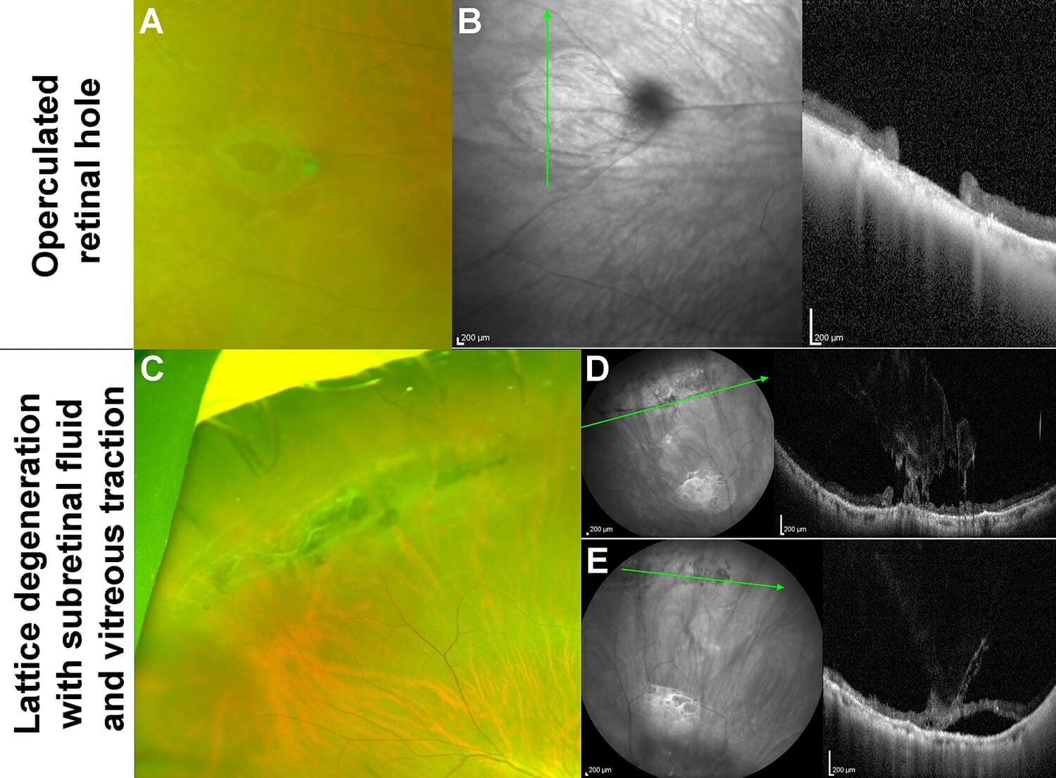Unconventional Uses of Optical Coherence Tomography - mivision