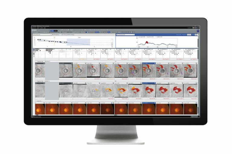 Zeiss Glaucoma Workplace - mivision