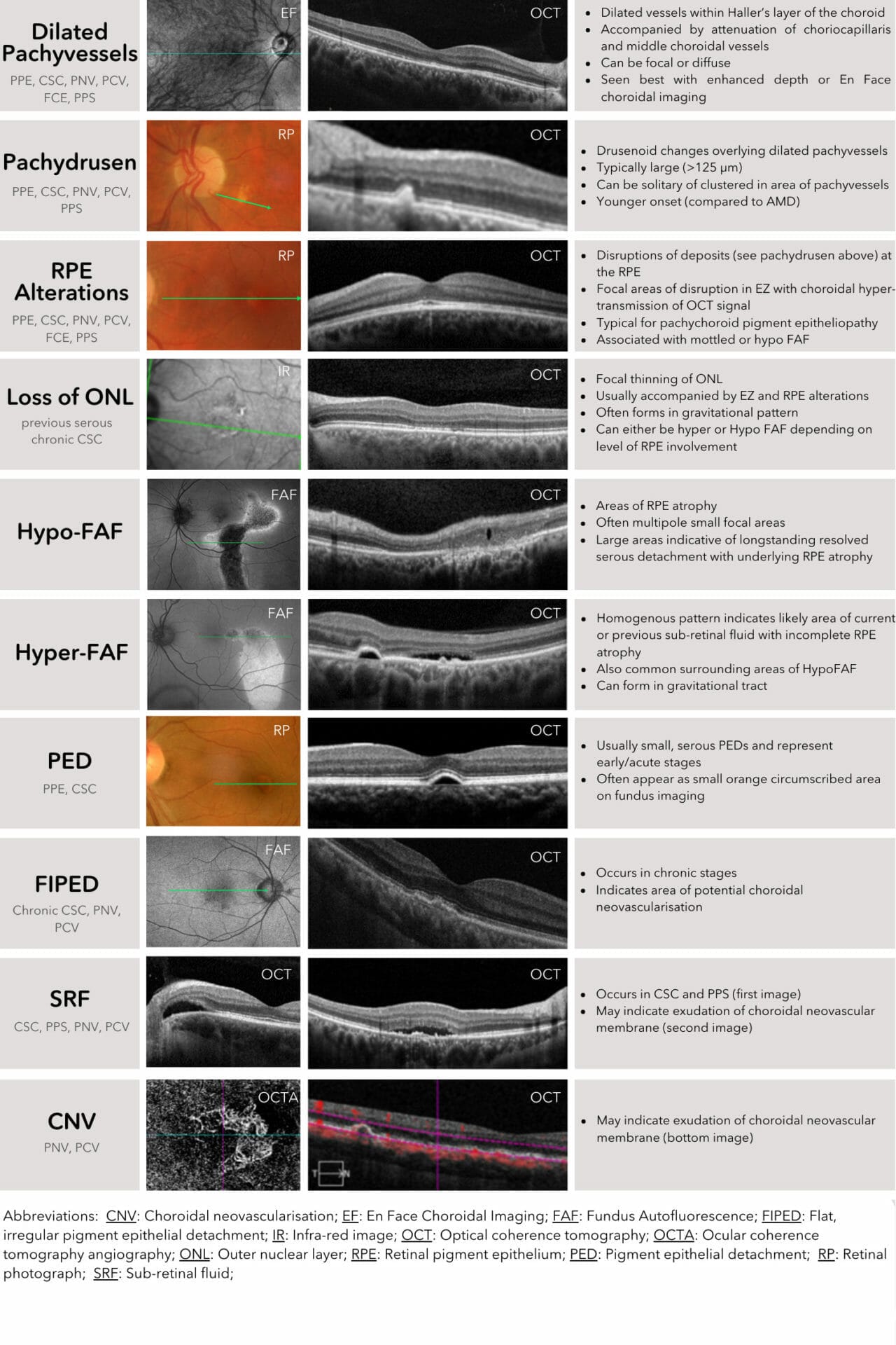 All the Colours of the Pachychoroid Spectrum - mivision