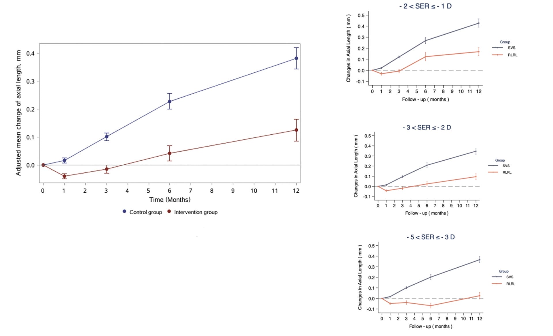 RLRL: A New Myopia Control Strategy - mivision