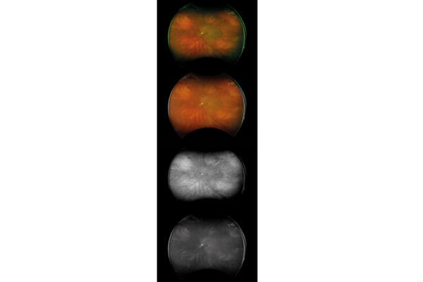 Optos: Now with More Image Modalities - mivision