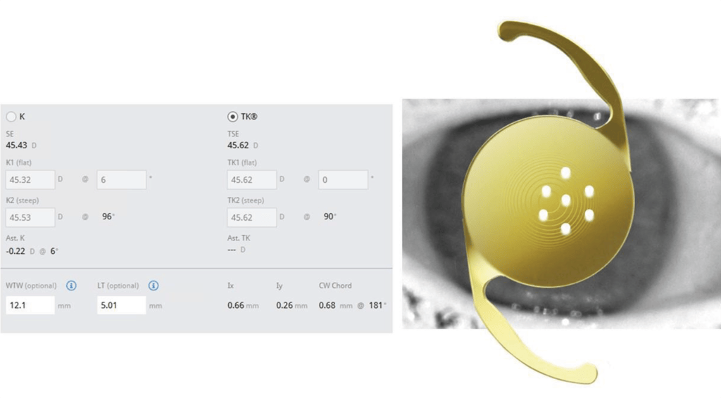Presbyopia-Correcting IOLs: Shaping the Future of Clear Vision - mivision