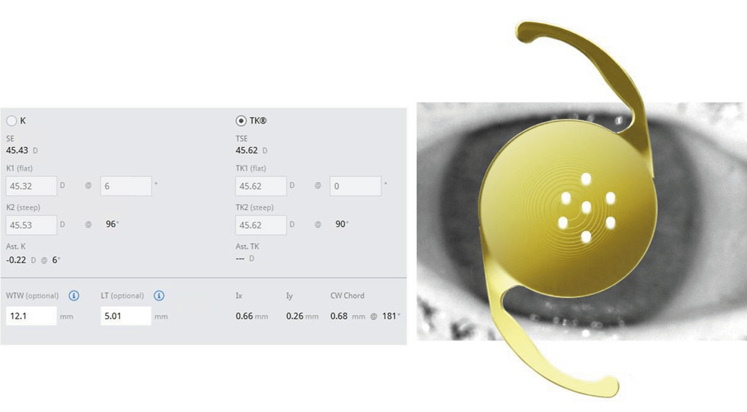 Presbyopia-Correcting IOLs: Shaping the Future of Clear Vision - mivision