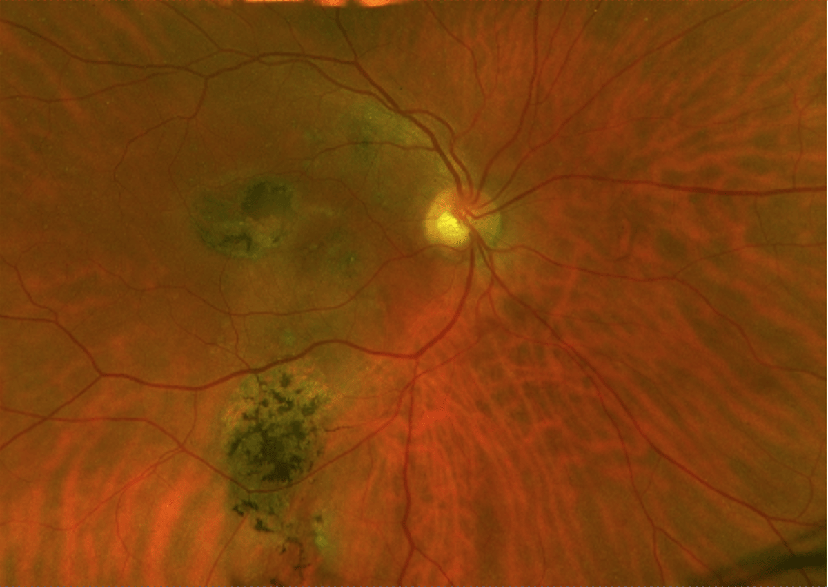 Making Sense of the Retinal Fingerprint in Clinical Practice - mivision