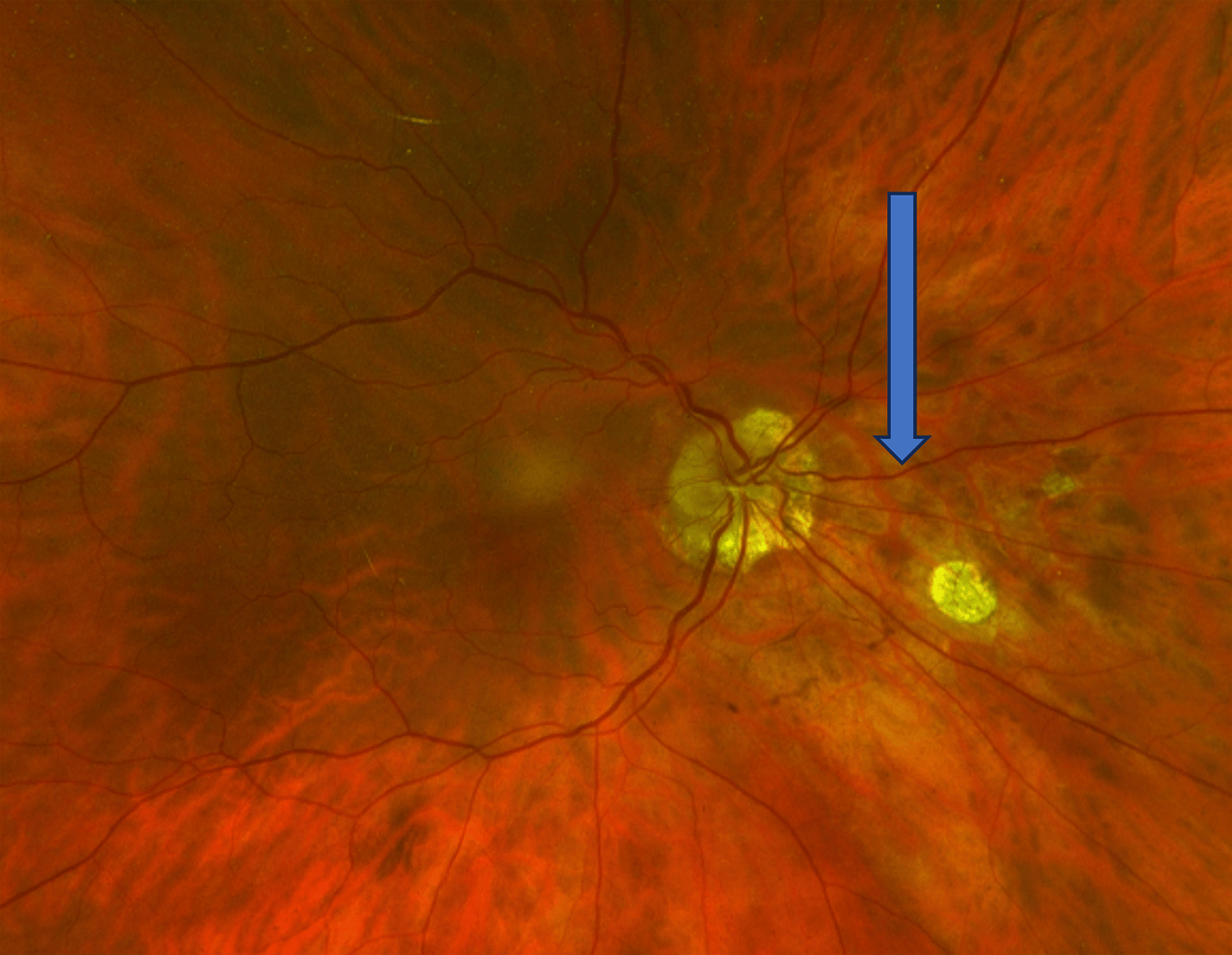 Making Sense of the Retinal Fingerprint in Clinical Practice - mivision