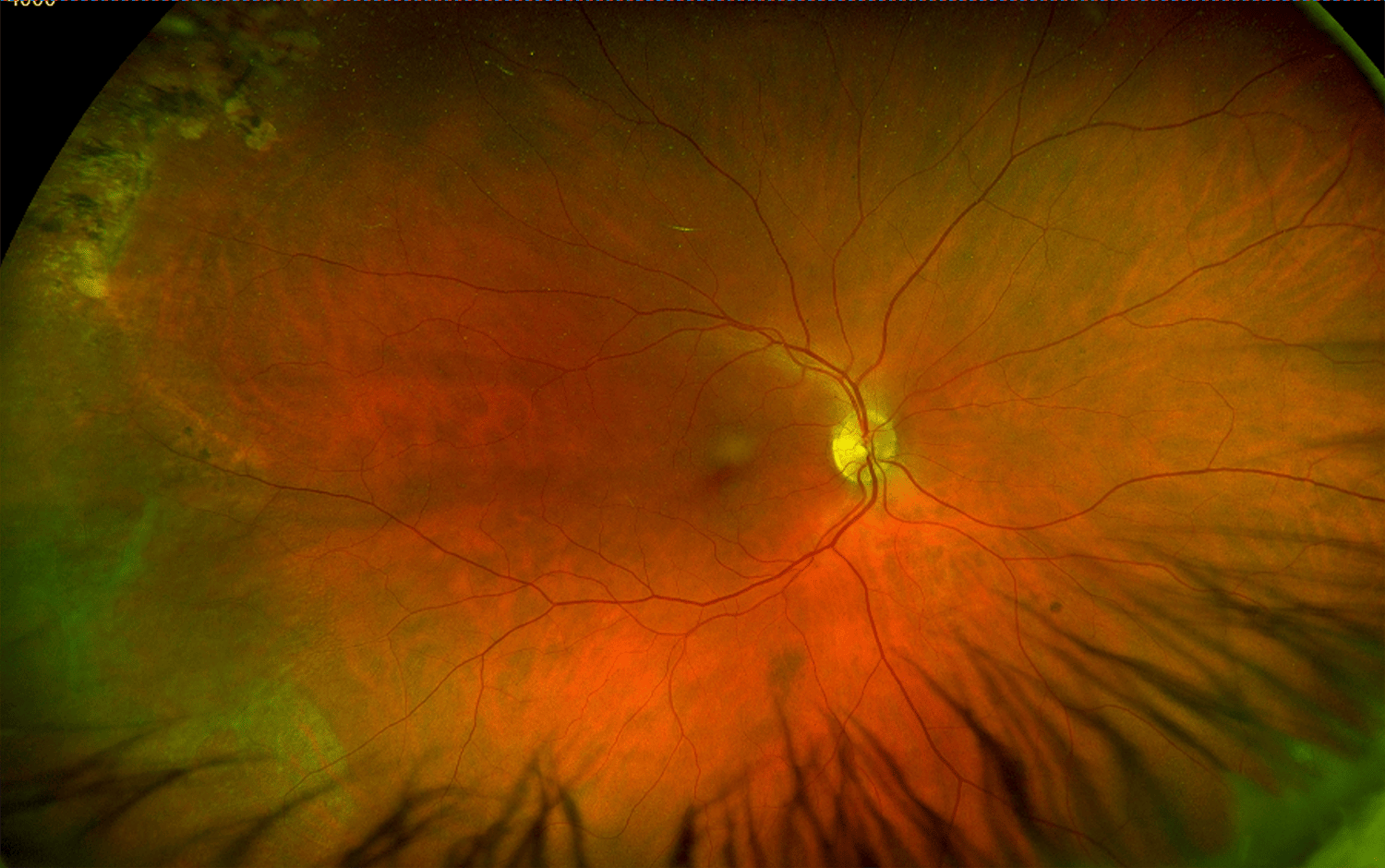 Making Sense of the Retinal Fingerprint in Clinical Practice - mivision