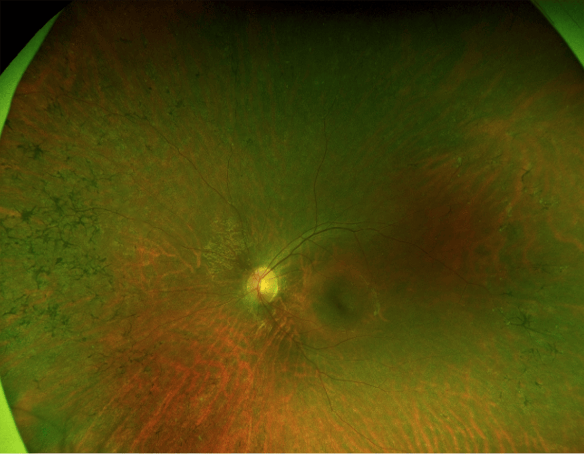 Making Sense of the Retinal Fingerprint in Clinical Practice - mivision