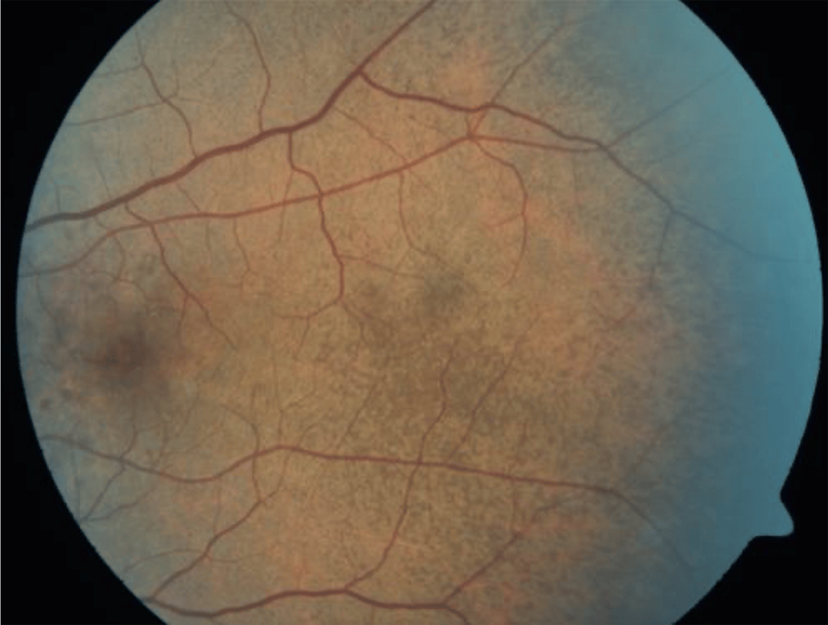 Making Sense of the Retinal Fingerprint in Clinical Practice - mivision