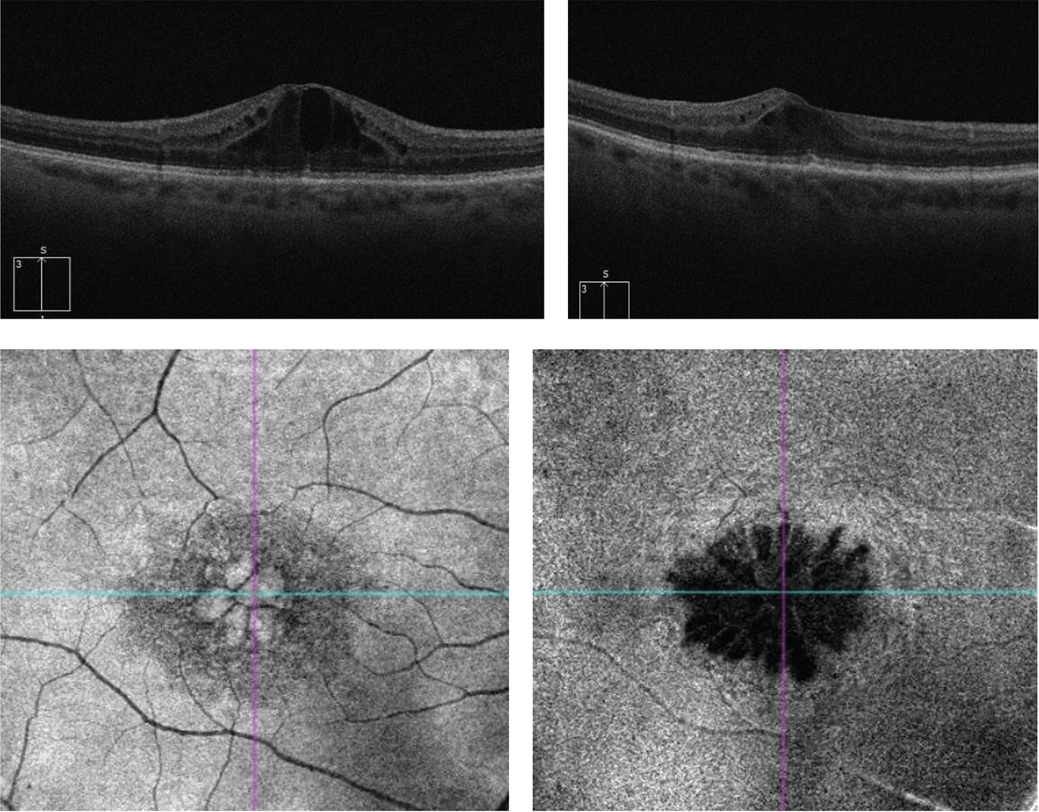 Making Sense of the Retinal Fingerprint in Clinical Practice - mivision