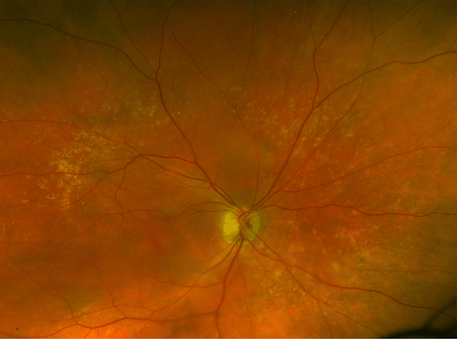 Making Sense of the Retinal Fingerprint in Clinical Practice - mivision