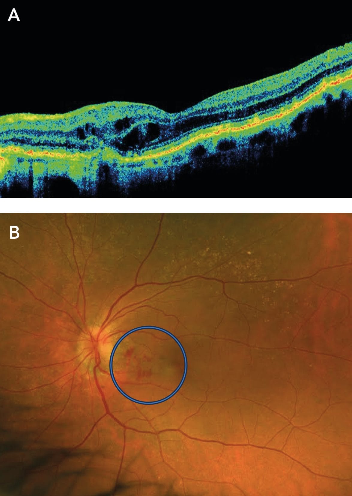 Making Sense of the Retinal Fingerprint in Clinical Practice - mivision