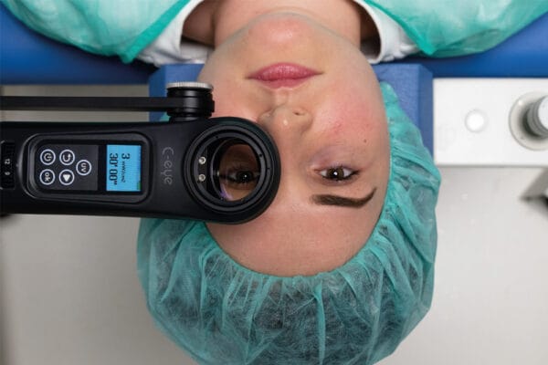 C-eye for Corneal Cross-Linking - mivision