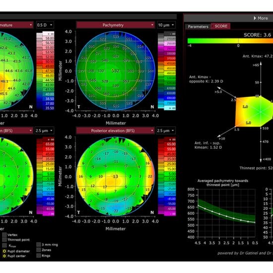 3D Map of DNA Within Retinal Cells - mivision