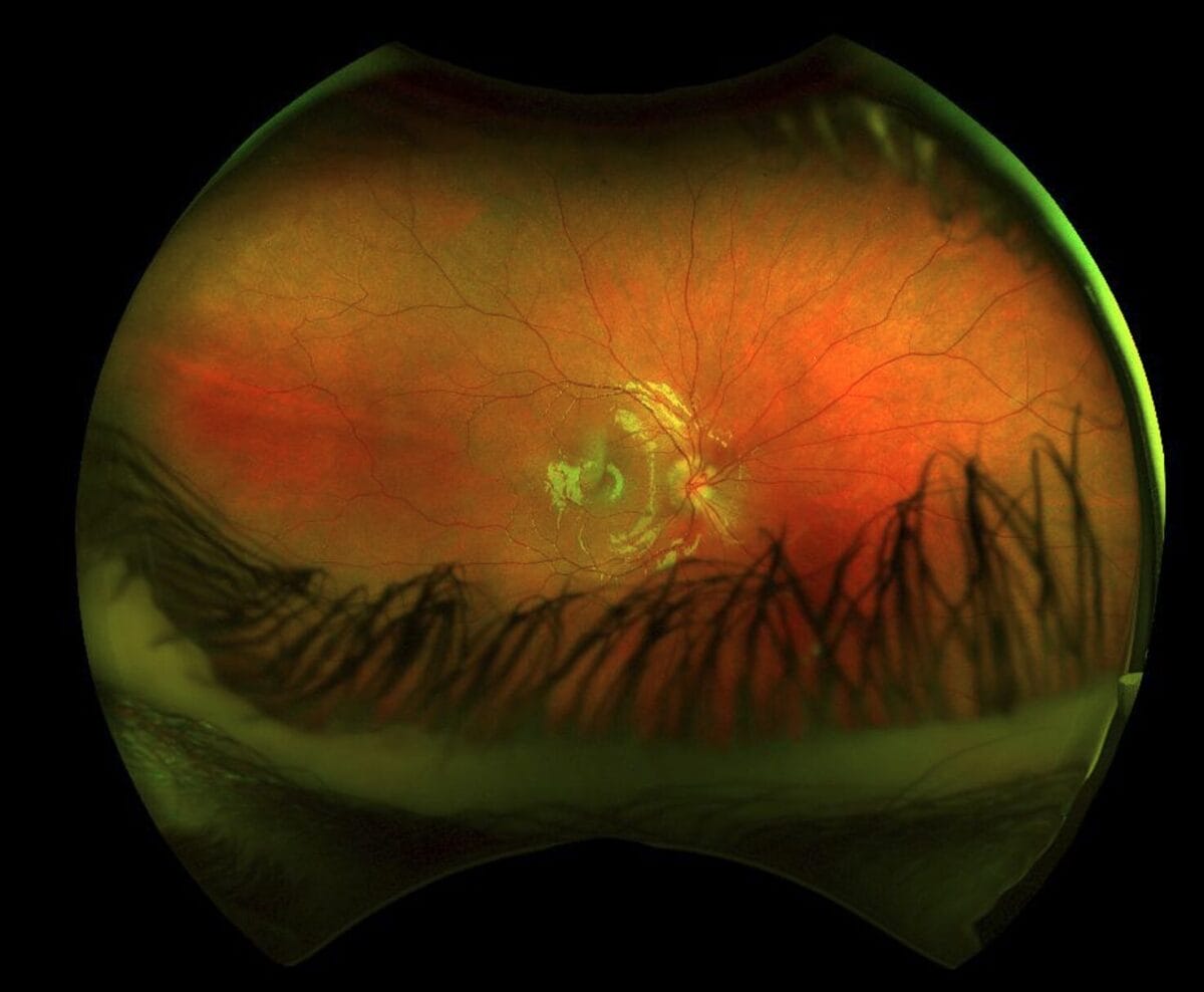 The Three ‘A’s in Clinical Practice: A Guide - mivision