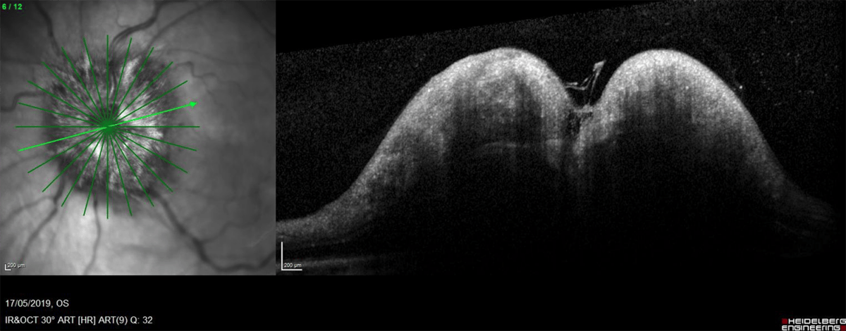 The Three ‘A’s in Clinical Practice: A Guide - mivision