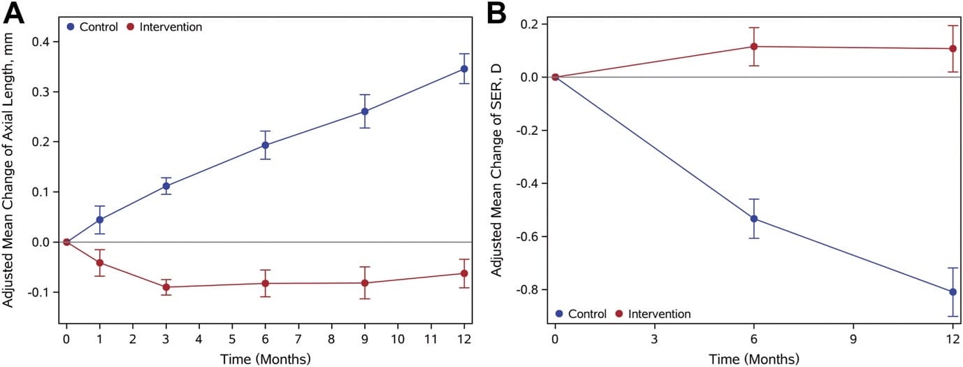 RLRL Effective for High Myopia - mivision