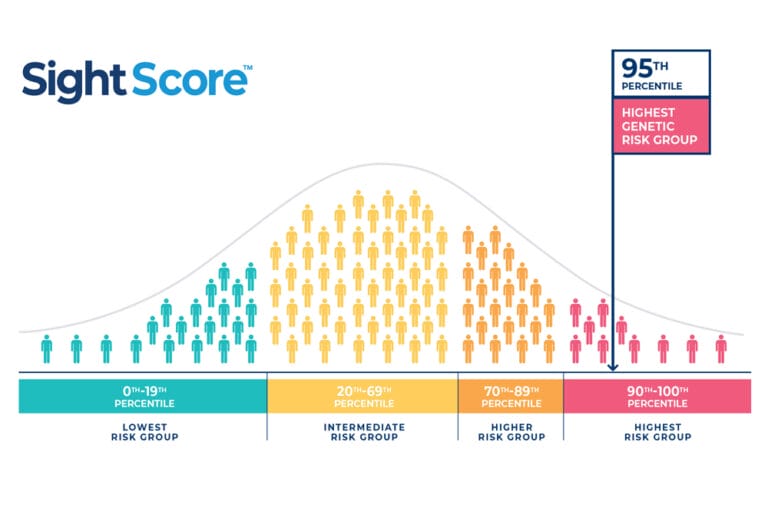 SightScore Glaucoma Genetic Risk Assessment - mivision