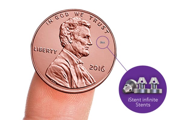 iStent infinite - mivision