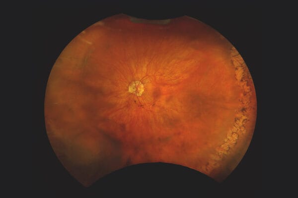 See More, Treat More with optomap - mivision