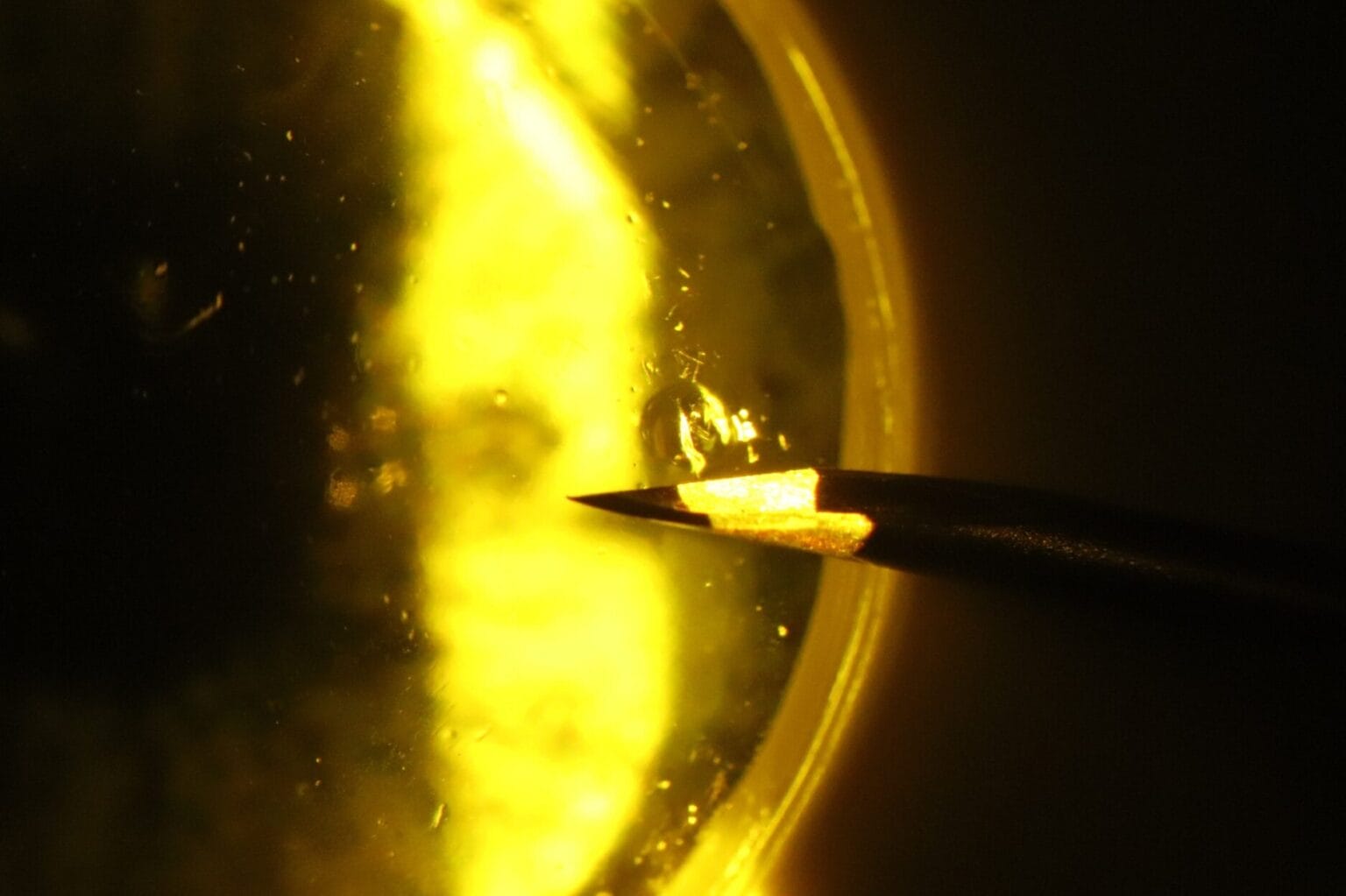 Paediatrics, Anterior Segment CPD Return to ACO - mivision