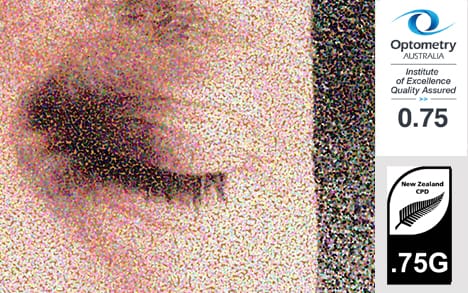 Lights Off: Sleep and Myopia - mivision