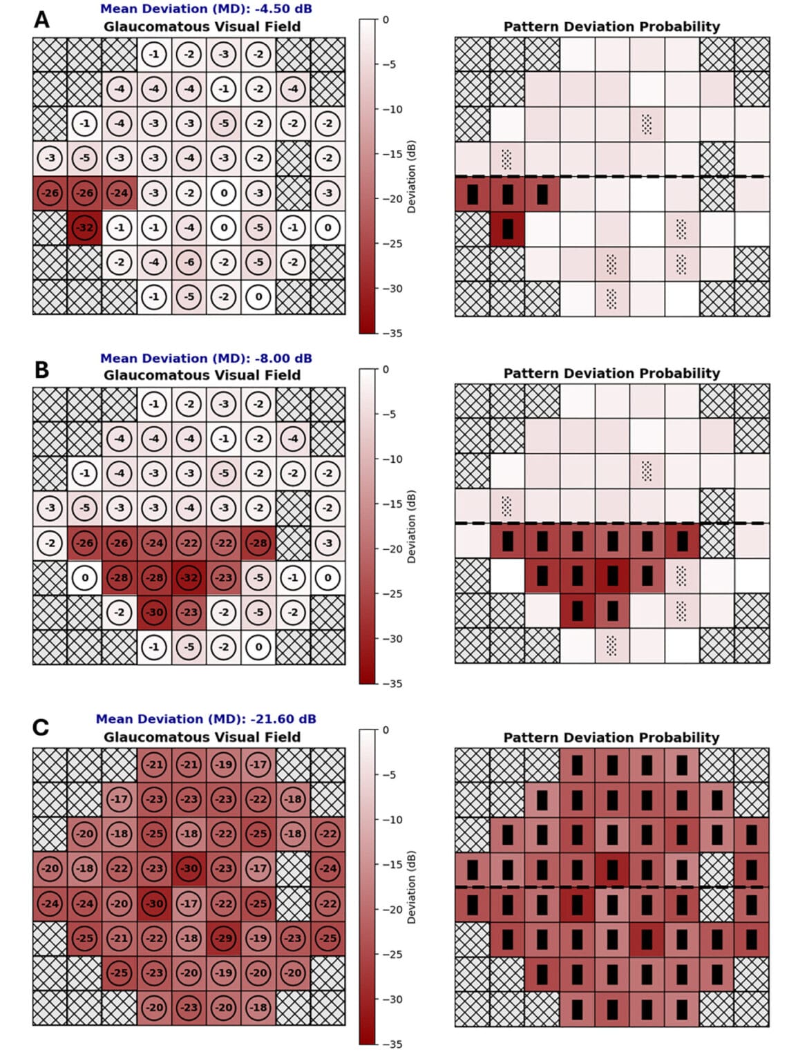 Visual Field Testing: A Guide to Interpreting Reports - mivision