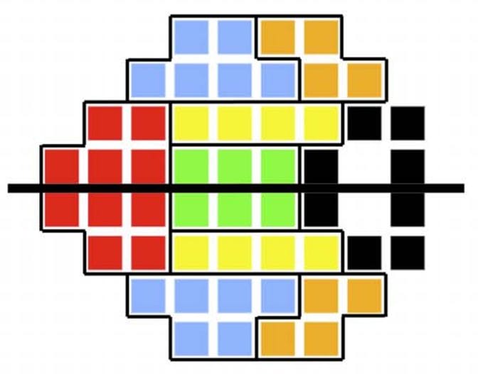 Visual Field Testing: A Guide to Interpreting Reports - mivision