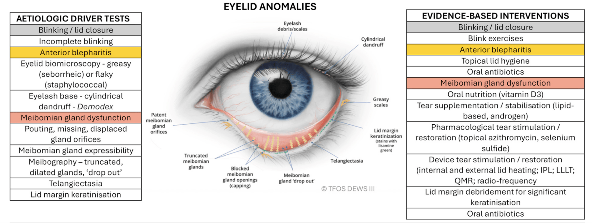 What’s In, What’s Out? DEWS III and the Future of Dry Eye Care - mivision