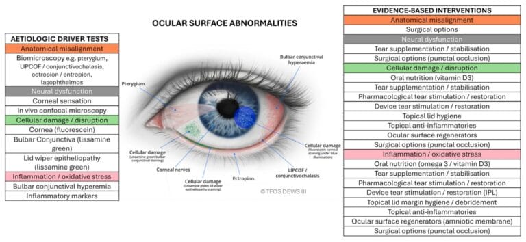 What’s In, What’s Out? DEWS III and the Future of Dry Eye Care - mivision