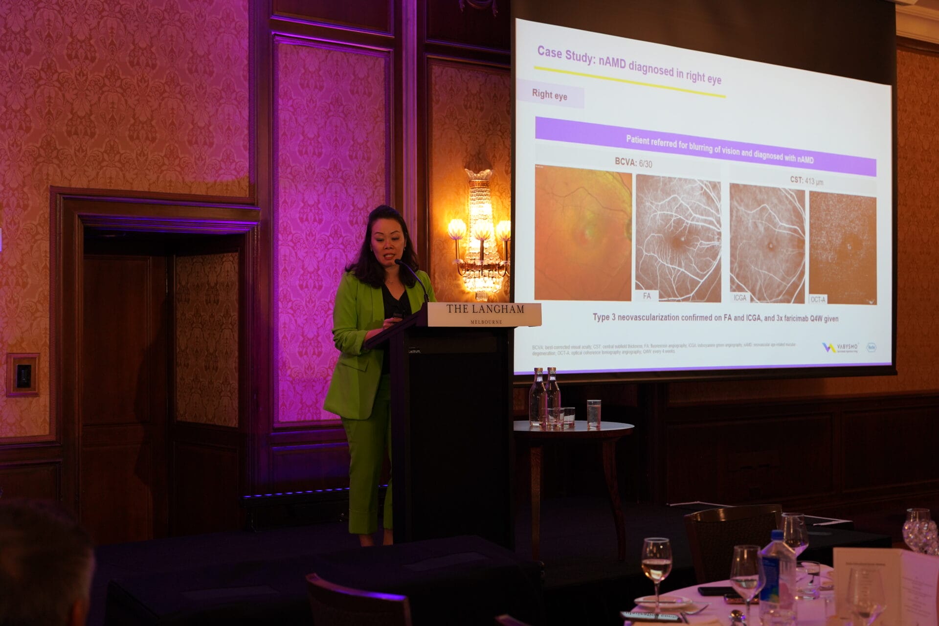 Real-World Insights on Wet AMD Management - mivision