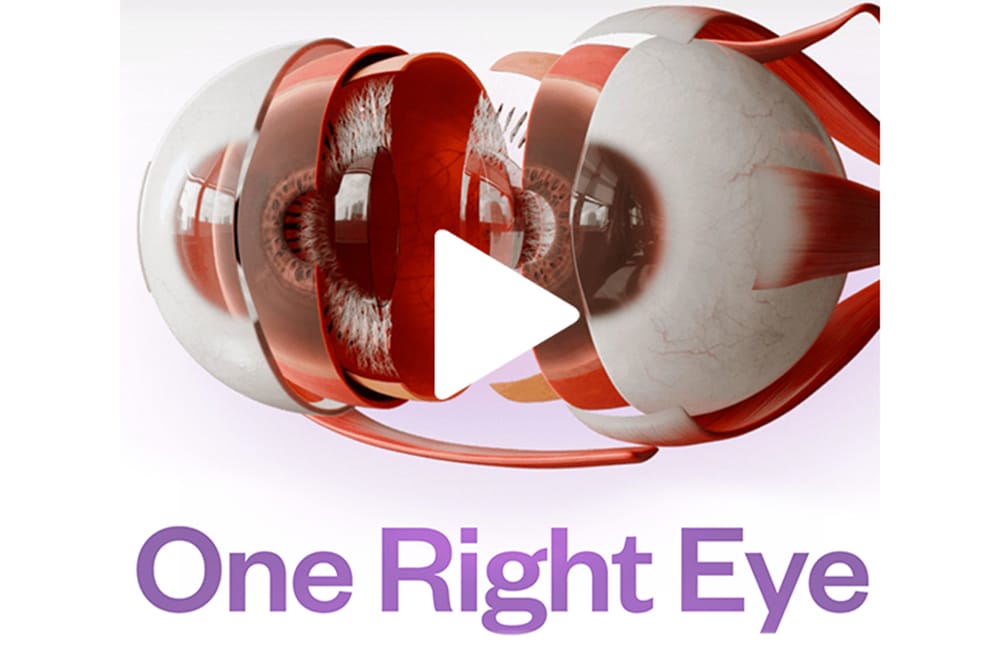 One Right Eye: A Patient Education Tool for Eye Care - mivision